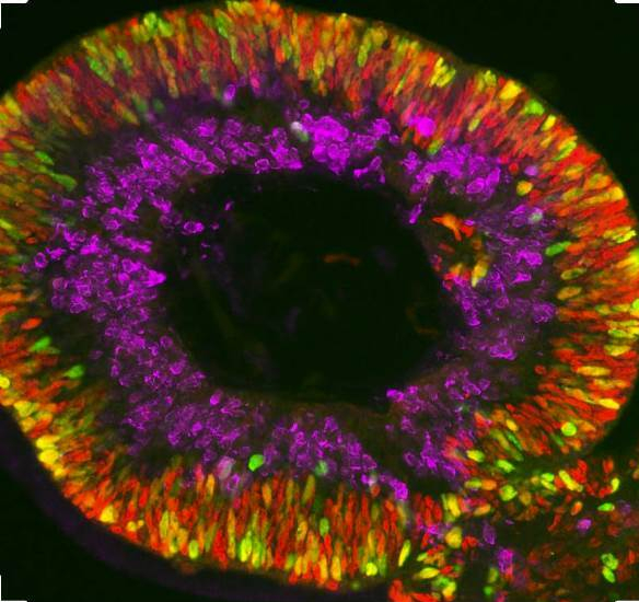 Explained: How lab-grown organoids can transform medicine | Science ...